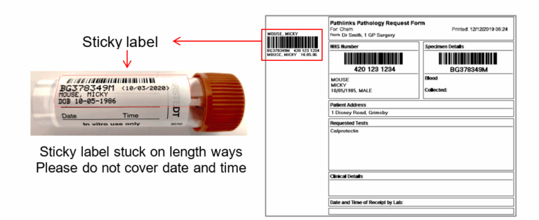 Faecal Calprotectin Test - Northern Lincolnshire and Goole NHS ...